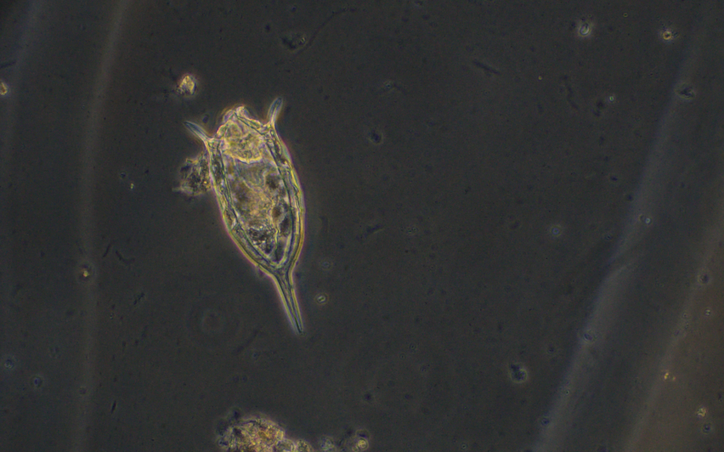 Rotifer (keratella) - Lilly Center for Lakes & Streams