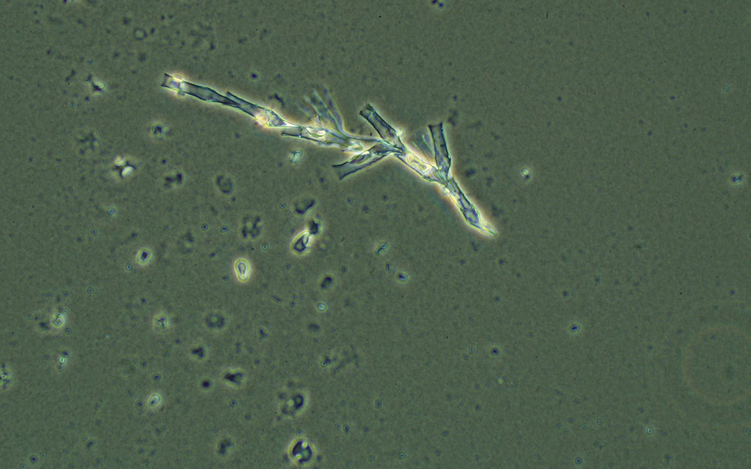 Native, non-native and invasive species... what's the difference?